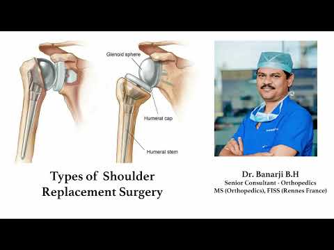 Types of Shoulder Replacement Surgery | Sakra World Hospital