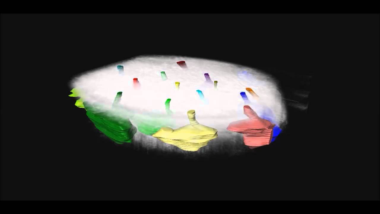 PLoS ONE : Optical Coherence Tomography Identifies Lower Labial Salivary Gland Surface Density...