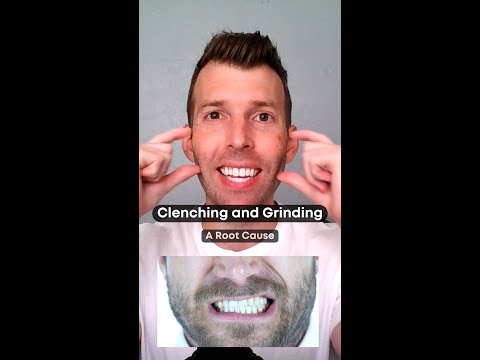 Clenching and Grinding Teeth (a root cause)
