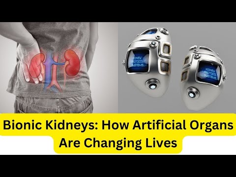 Bionic Kidneys: How Artificial Organs Are Changing Lives
