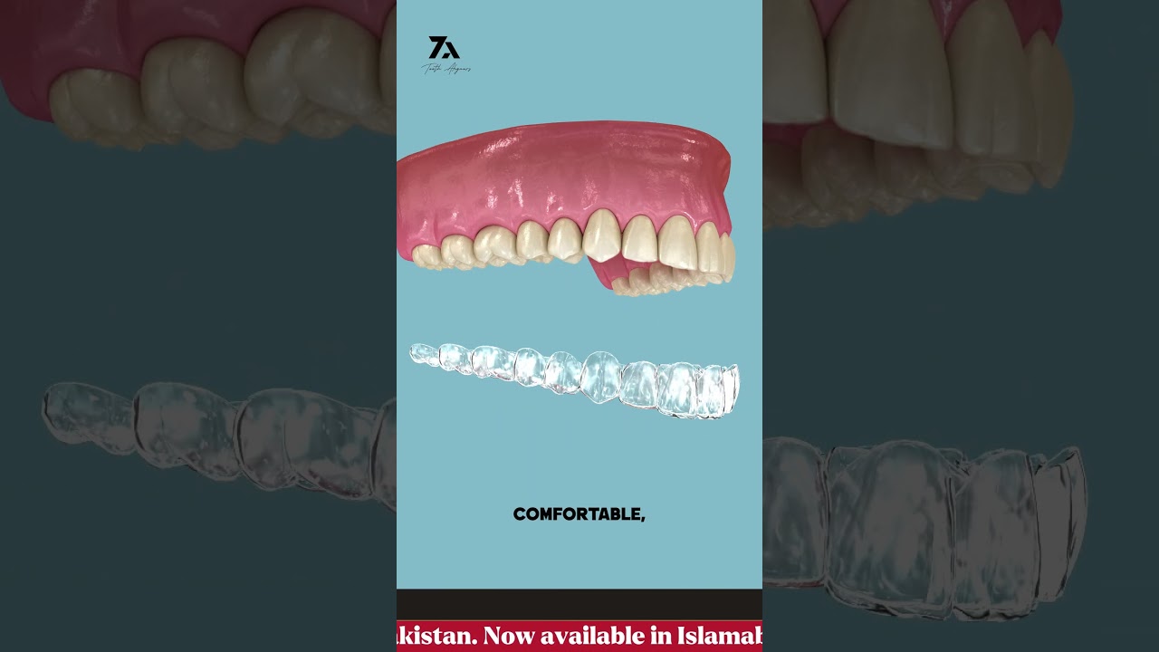 Say goodbye to crooked smiles, and hello to confidence.