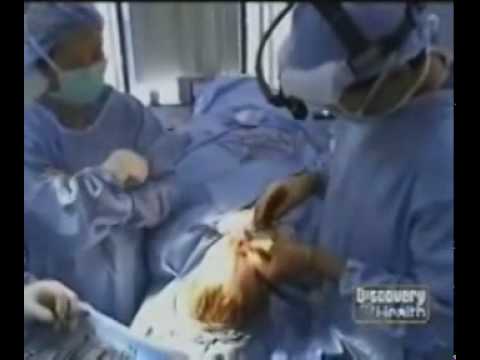 Dr. David W. Kim, San Francisco Facial Plastic Surgeon, on Discovery Channel
