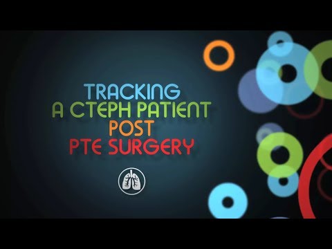 Tracking a CTEPH Patient Post PTE Surgery