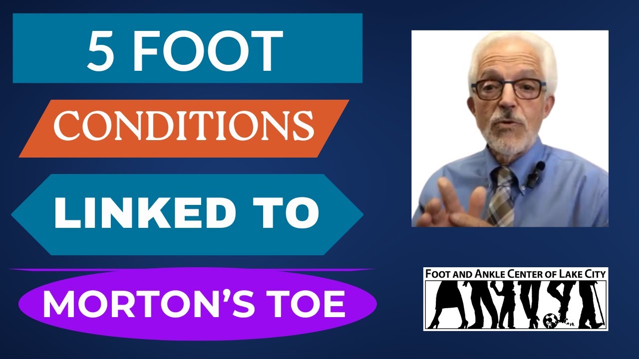 5 Painful Foot Conditions Linked to Morton's Toe | Foot and Ankle ...