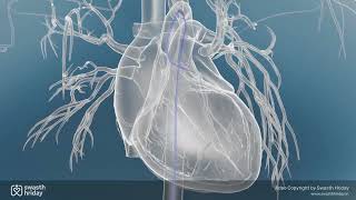 Heart Angiography Explained | Cardiac Catheterization