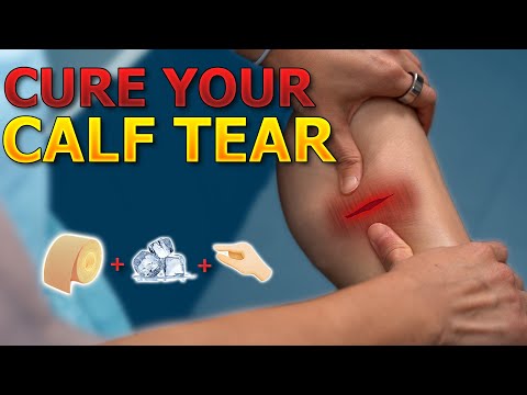 Is Your Calf Torn? (Testing, Taping, and Other Tips)