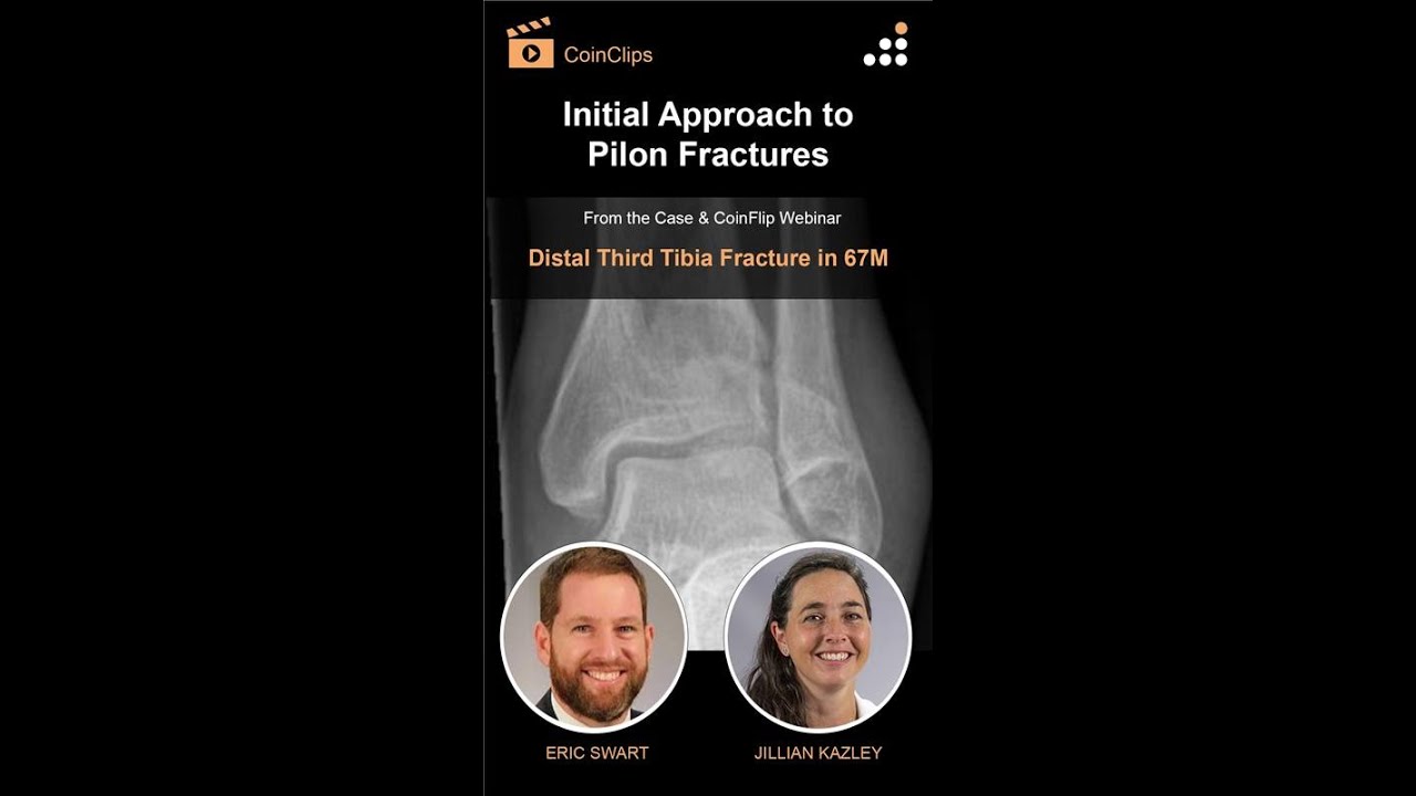 Initial Approach to Pilon Fractures