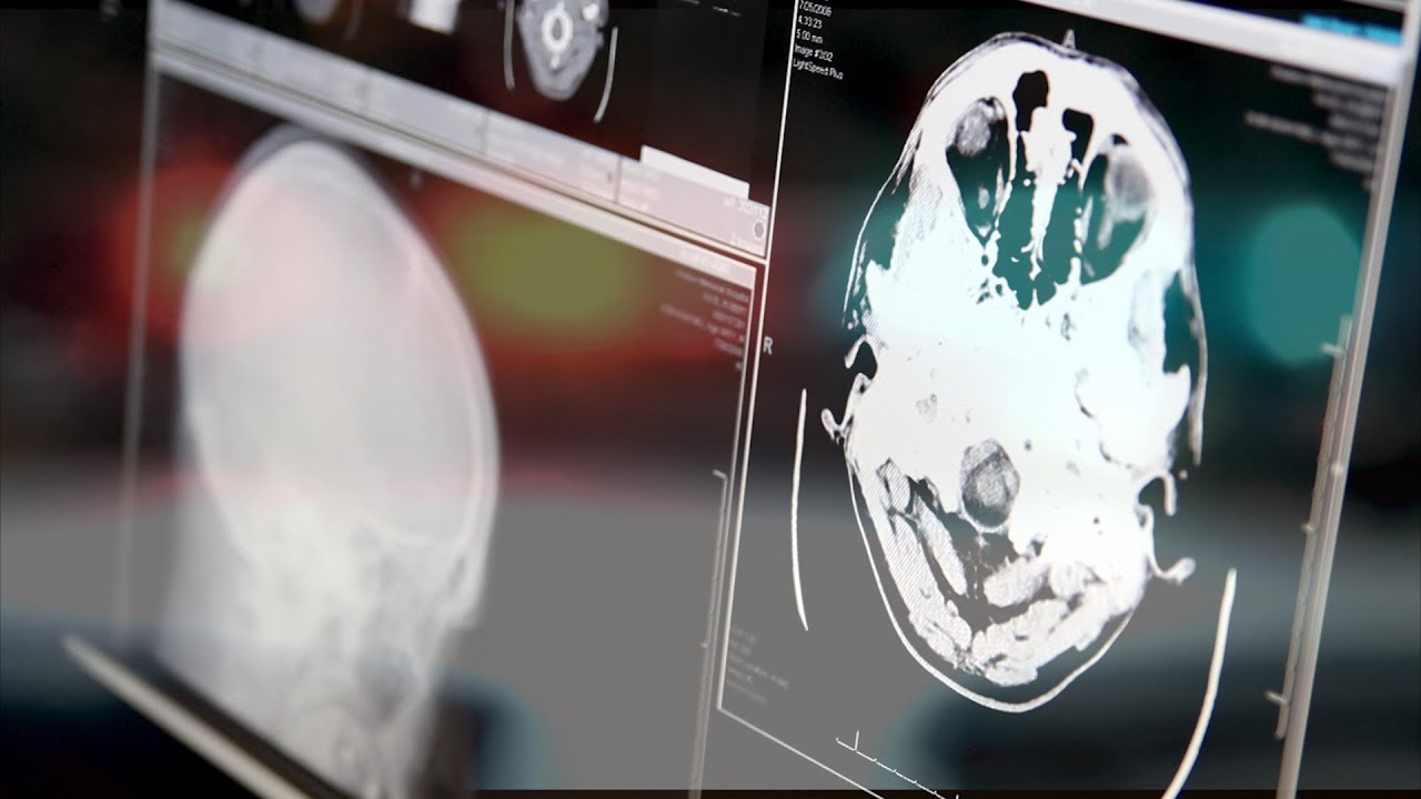 Brain Injuries & Concussions | Health Matters | KSPS PBS
