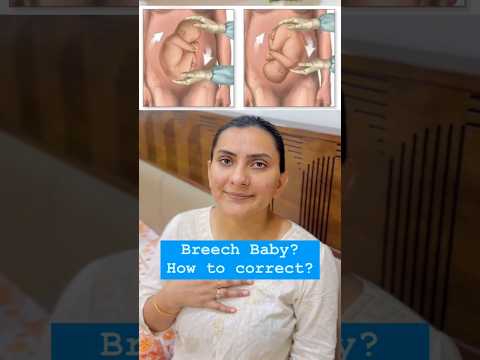 Turn your Breech baby with yoga! 🤰🏻