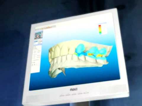 systemoverview Sm Prog