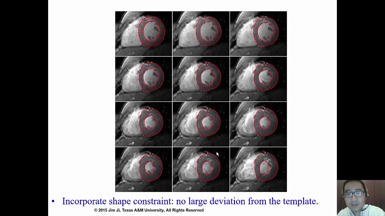 Lecture 2 Medical Image Processing