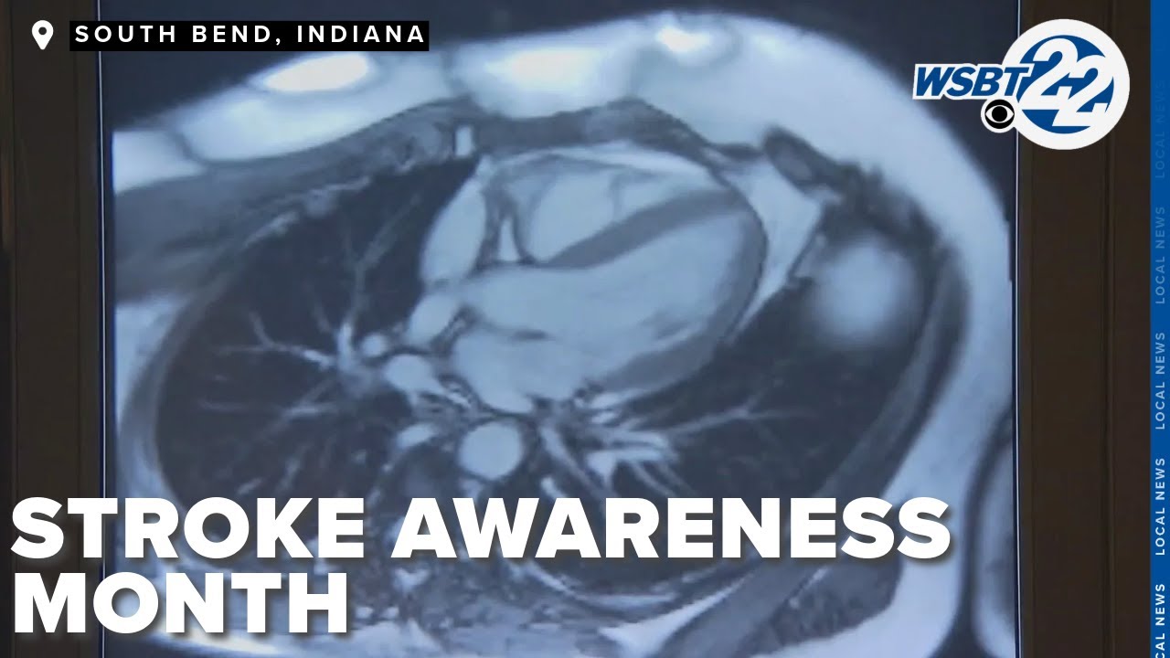 May is National Stroke Awareness Month