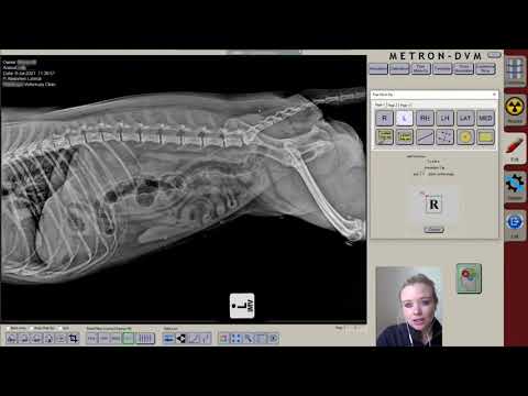 ClaroX DR System Software: Calibrations and Measurements - video 4