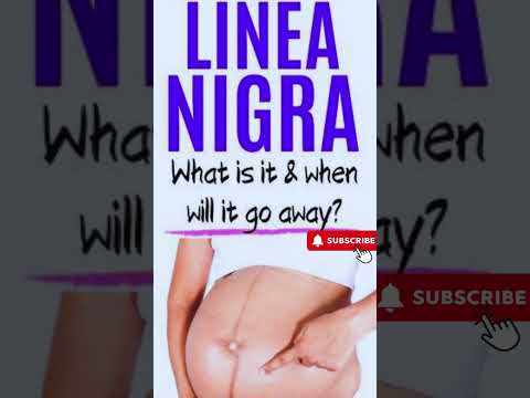 What is Linea Nigra ? Your Pregnancy Belly Line Explained ! #shortvideo #healthcare