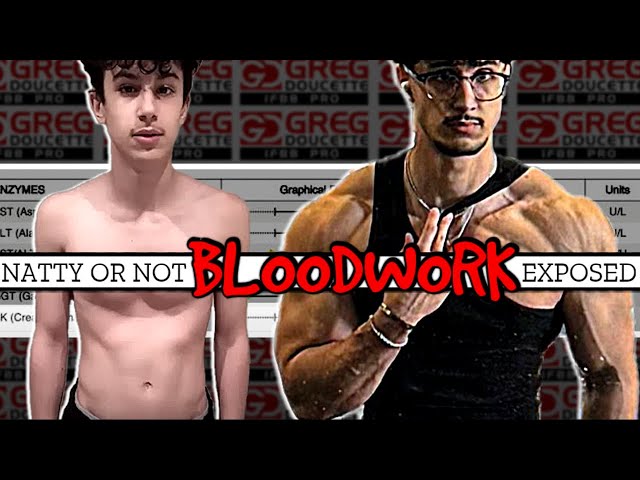 Greg Doucette contradicts himself, believes Hussein Farhat to have "one ...