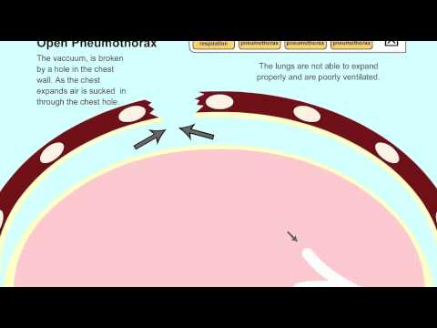 Understanding Pneumothorax in Dogs and Cats