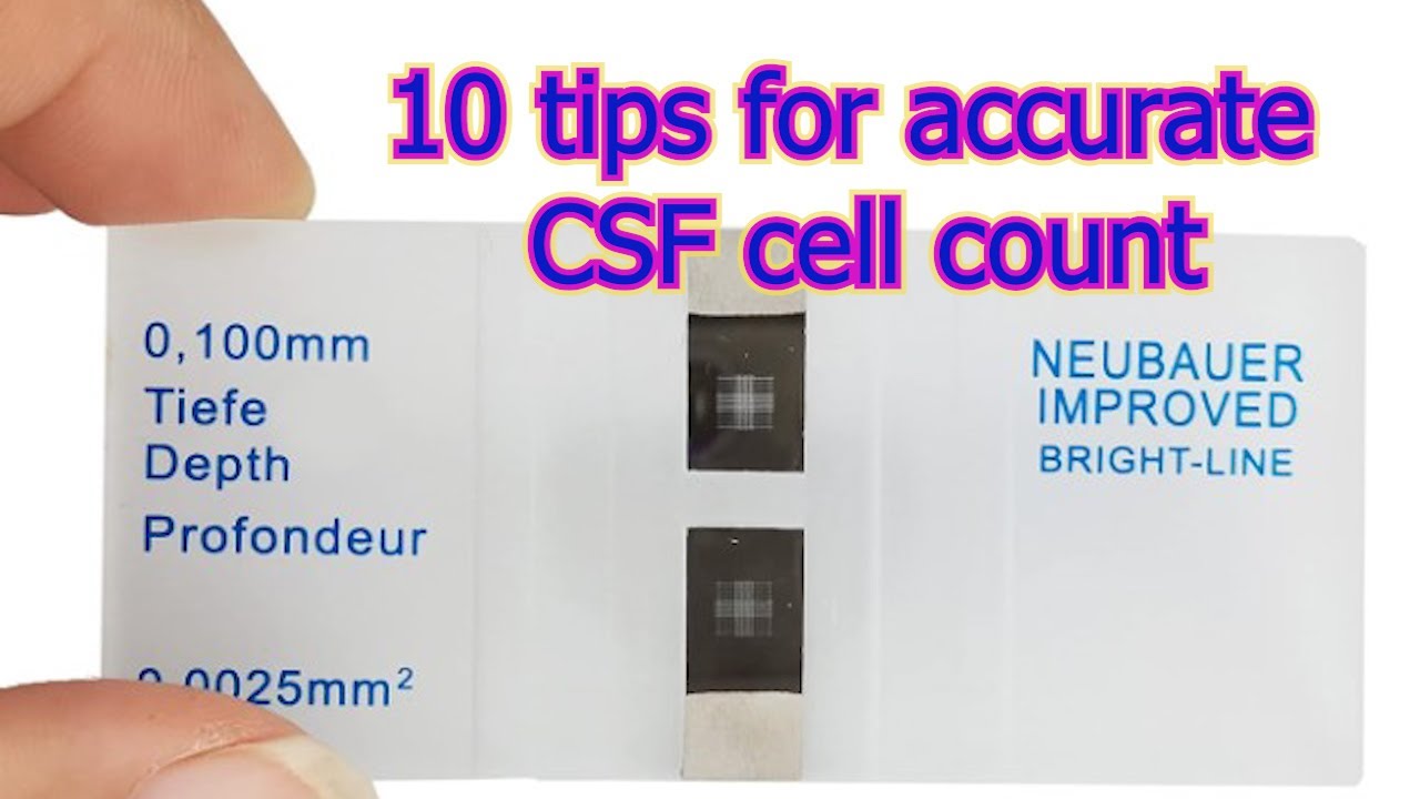 CSF Cell Count 10 Tips for accuracy