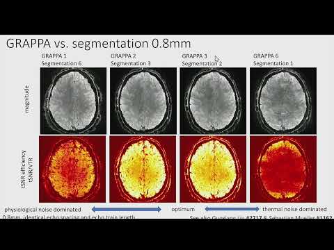 Data acquisition and analysis basics in layer-fMRI, Renzo Huber