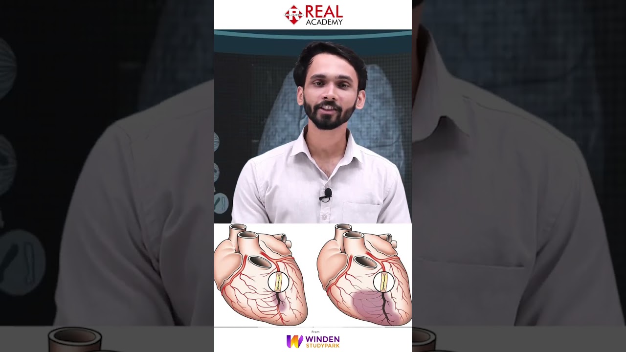 What is Collateral Circulation ?🔺👌👌🔺#trendingreels #trending #science #bloodcirculation
