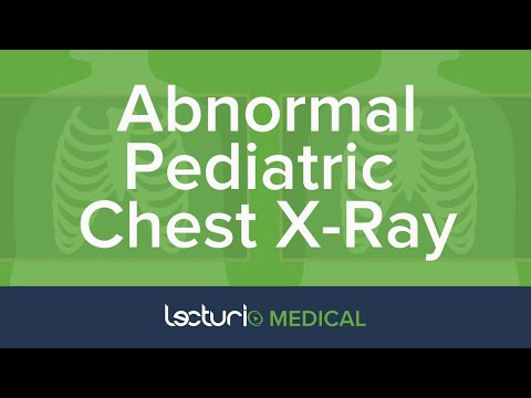 Abnormal Chest Findings in Pediatric Radiology