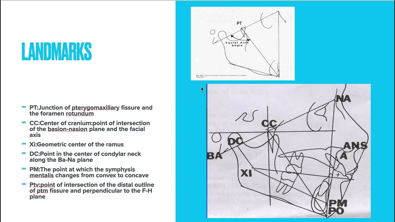 Ricketts' analysis(cephalometric analysis)