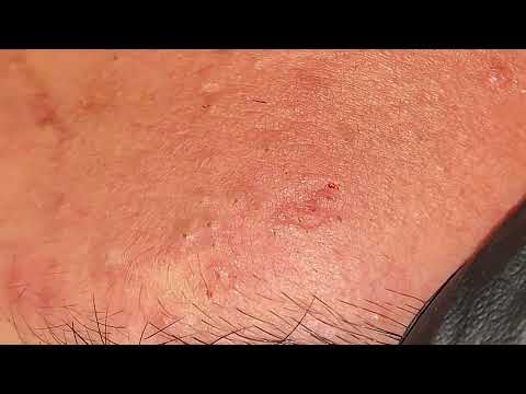 Skincare satisfying videos by Mahmoud Gamal #2005