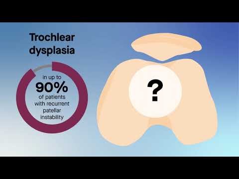 Unpacking the tibial tubercle–trochlear groove distance in patellar instability