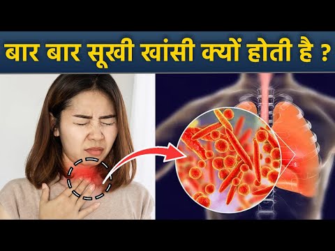 बार बार सूखी खांसी क्यों होती है | Baar Baar Sukhi Khasi Aane Ke Karan | Boldsky