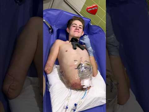il ne peut plus avoir d'enfants et a été coupé en deux voici ce qu'a fait sa copine