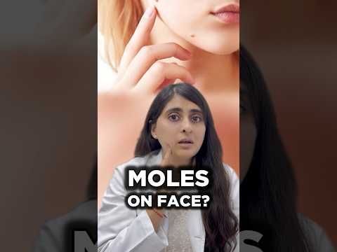 How to get rid of moles on skin | How to remove moles on face | Moles treatment dermatologist