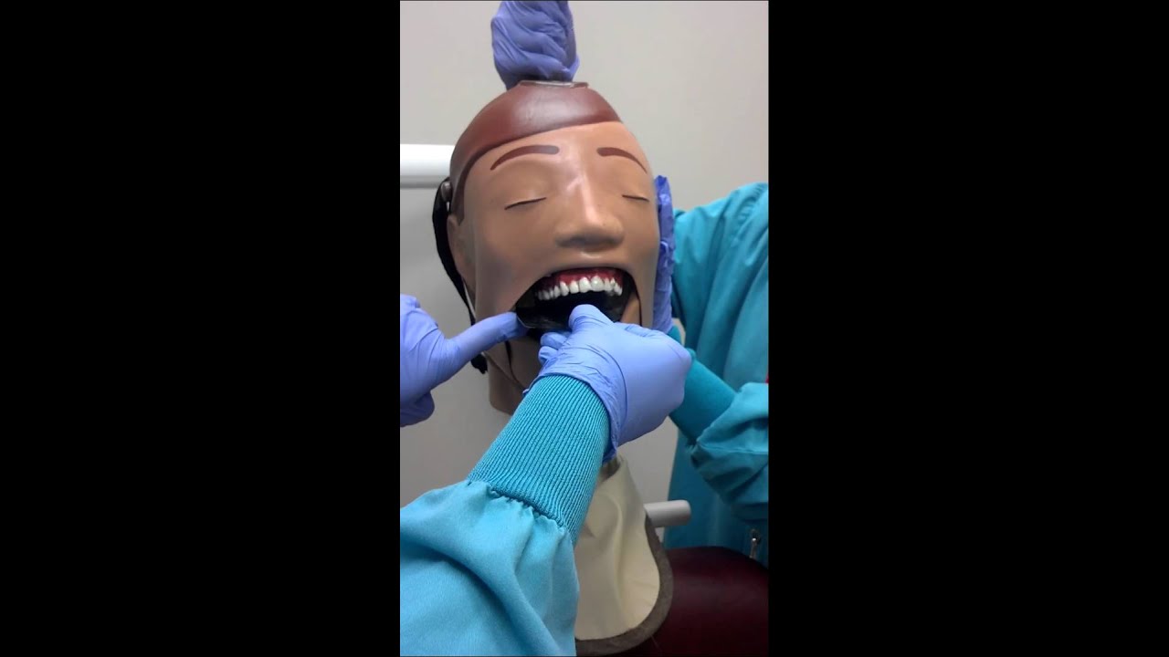 Maxillary Lateral Occlusal Radiograph