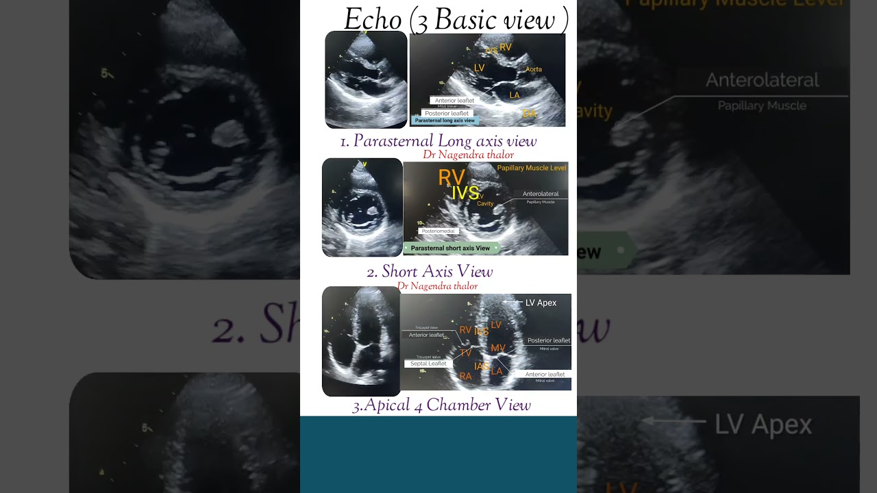 Basic echo view and heart parts #echo #shorts