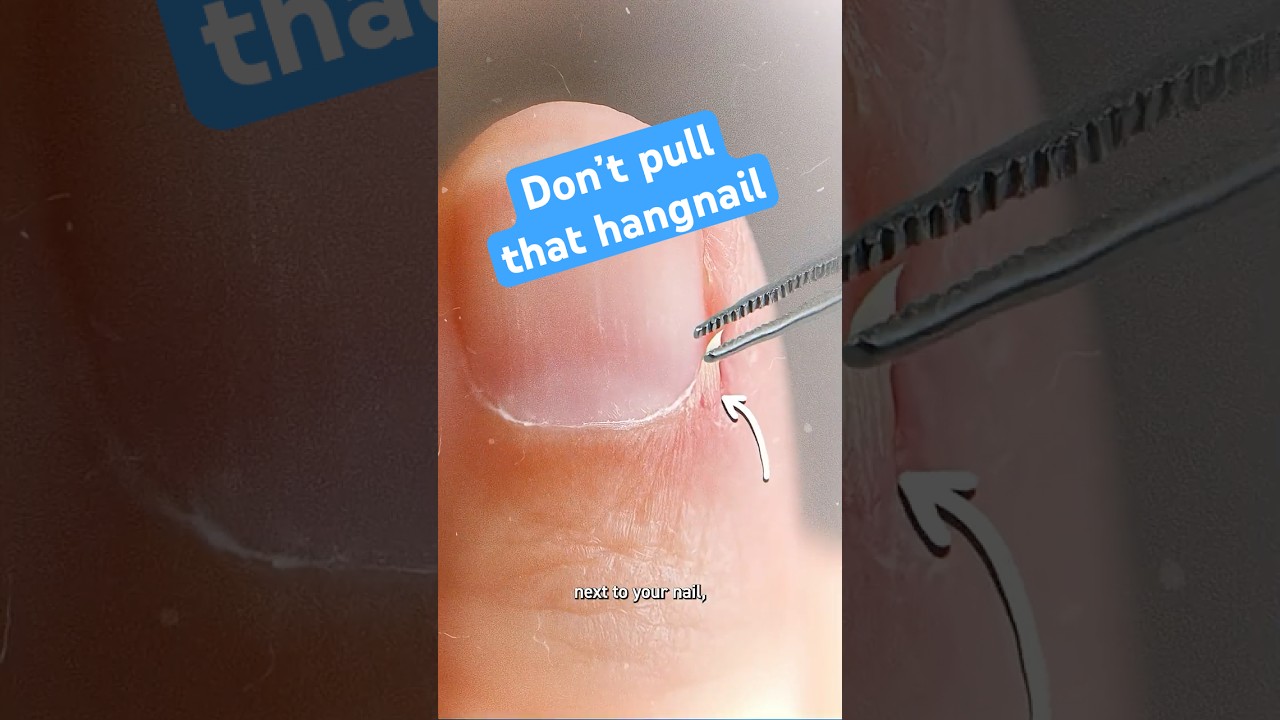 Don't Pull That Hangnail