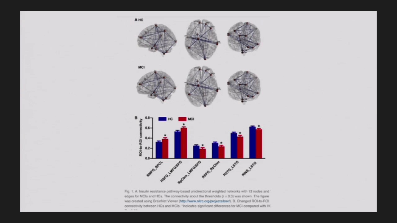 Imágenes cerebrales y minería de datos