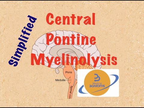 Central Pontine Myelinolysis, Osmotic Demyelination Syndrome, HYPONATREMIA in 6 min, COMLEX, USMLE