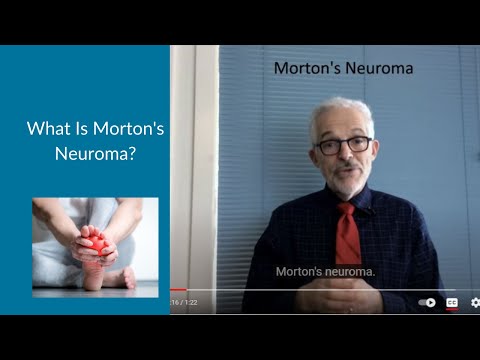 What is Morton's Neuroma?