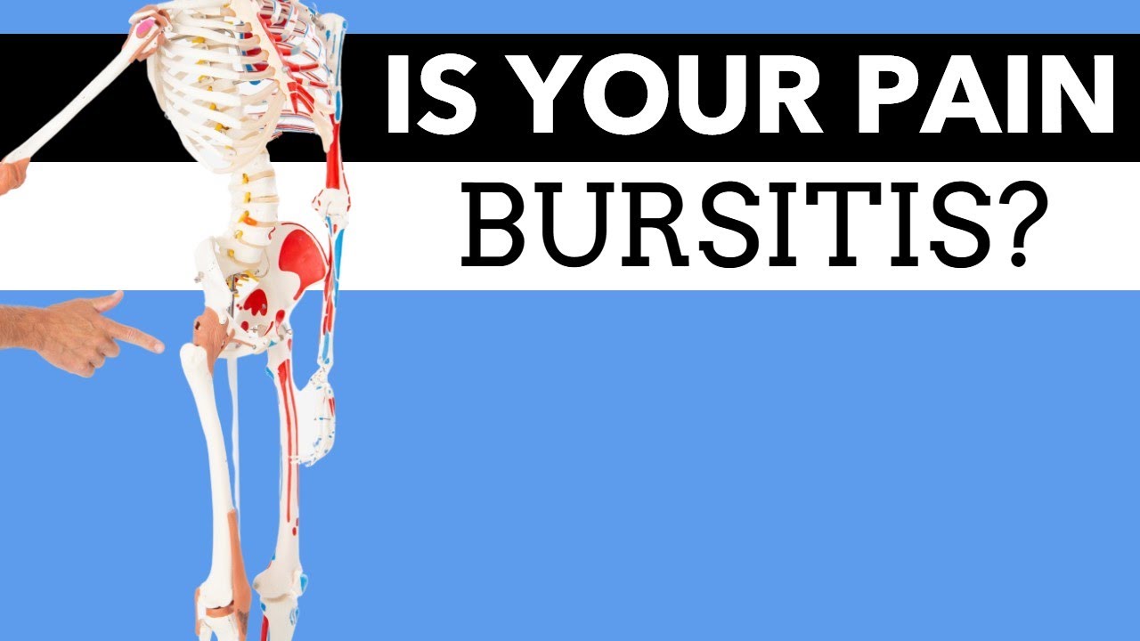 What Is Causing Your Hip Pain? Bursitis? How to Tell.