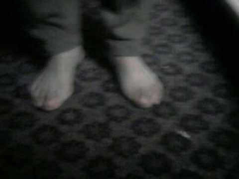 overlapping toes