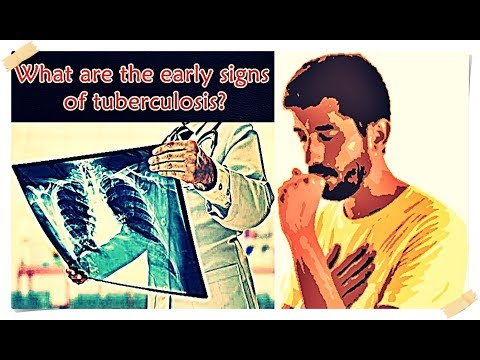 Positive TB Test - What does it look like?