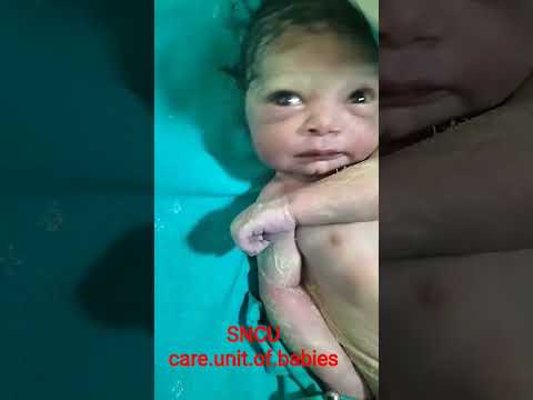 Different types of Look ๐ฎ๐ฎ๐ฎ๐ฎ#newbornbaby #youtubeshorts #trendingshorts