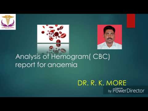 Analysis of Hemogram report for anemia- Dr. R .K. More