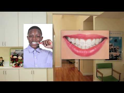 Invisalign, Clear Braces and Braces in Boston, Newton and Concord, Massachusetts: Best Treatments