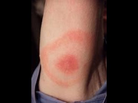 Erythema in Medicine 2