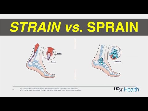 Strain vs. Sprain, Treatment