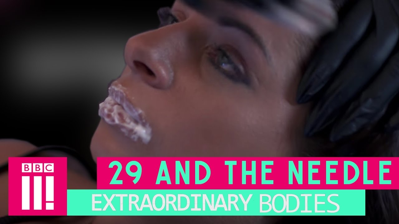 Addicted to Cosmetic Surgery | 29 and The Needle