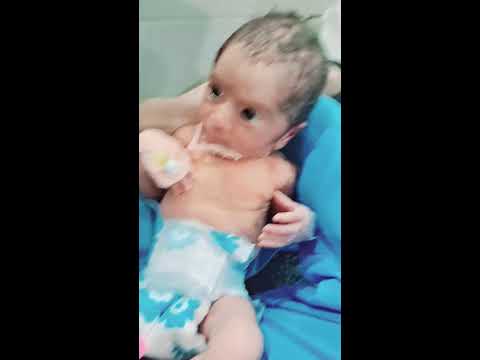 Live Babies reaction | New Born Babies Live Videos | Babies Live Moments | Neonatal Nicu Live