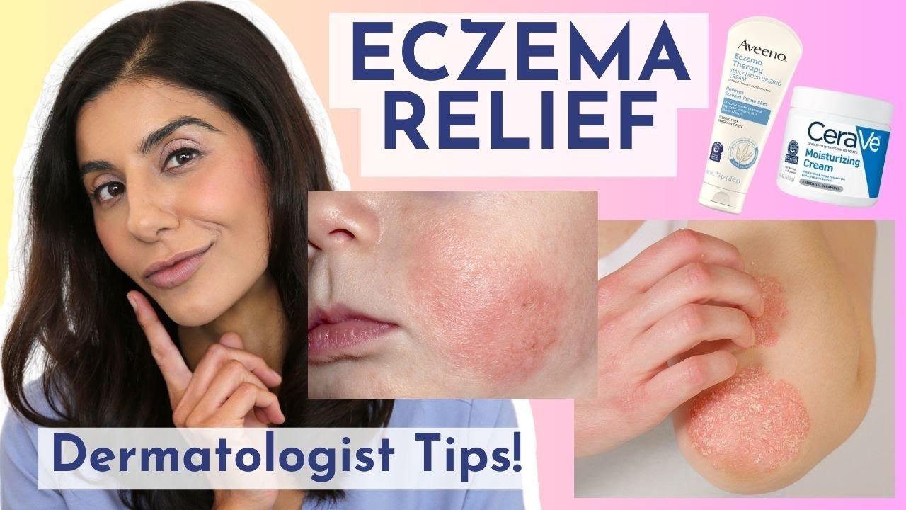Dermatologist’s Top Tips for Eczema Relief: Causes, Treatments, & Skincare