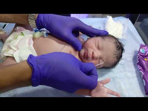 Initial Assessment of New born baby | APGAR Score | Vital sign |
