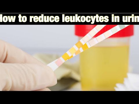 How to reduce leukocytes in urine