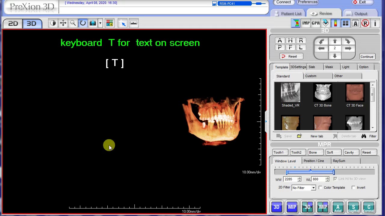 PreXion Training Tips: Add On-screen Annotations